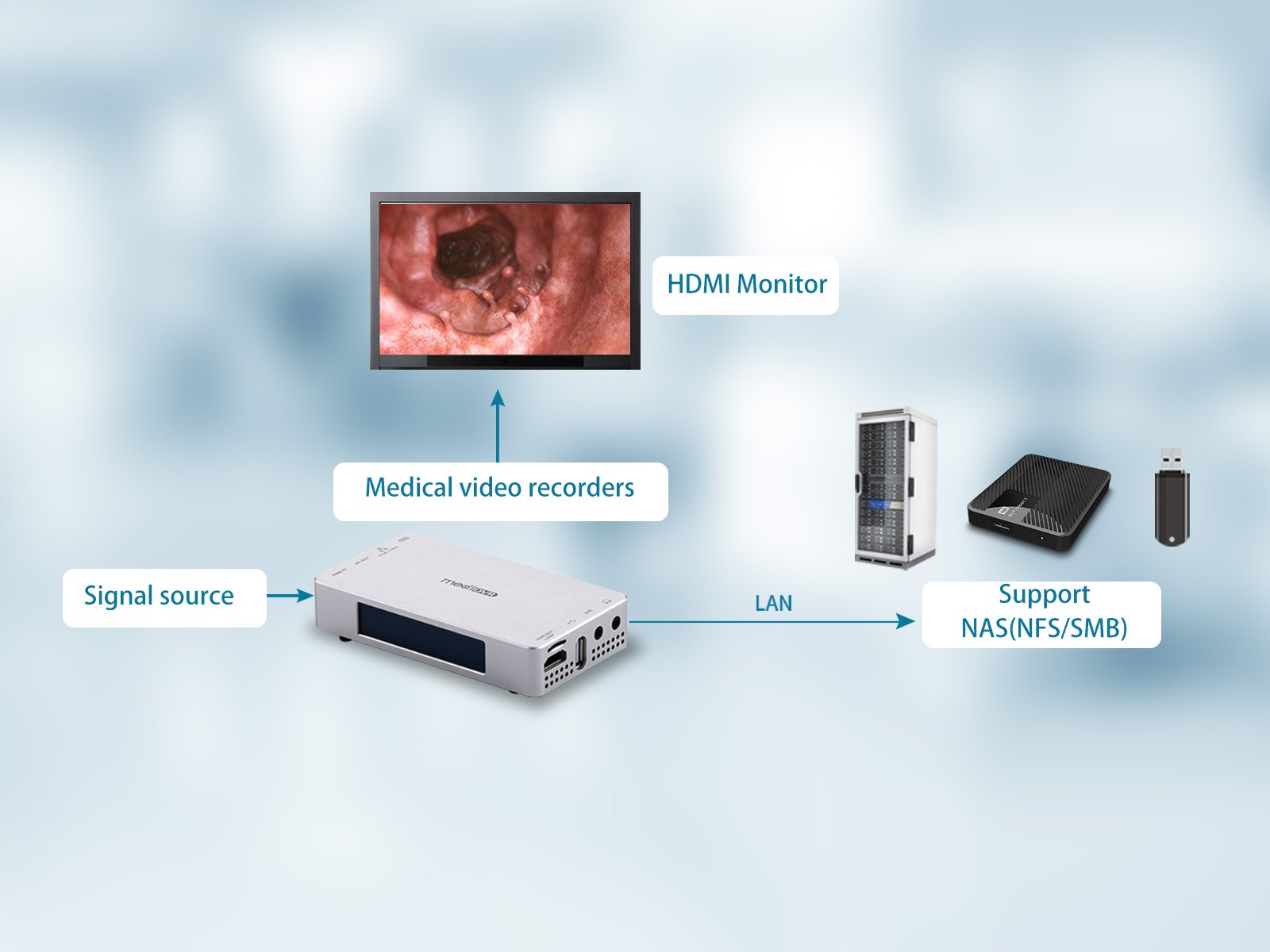 Zowietek-4K NDI Medical Video Recorder Lite—MediDVR, MD3